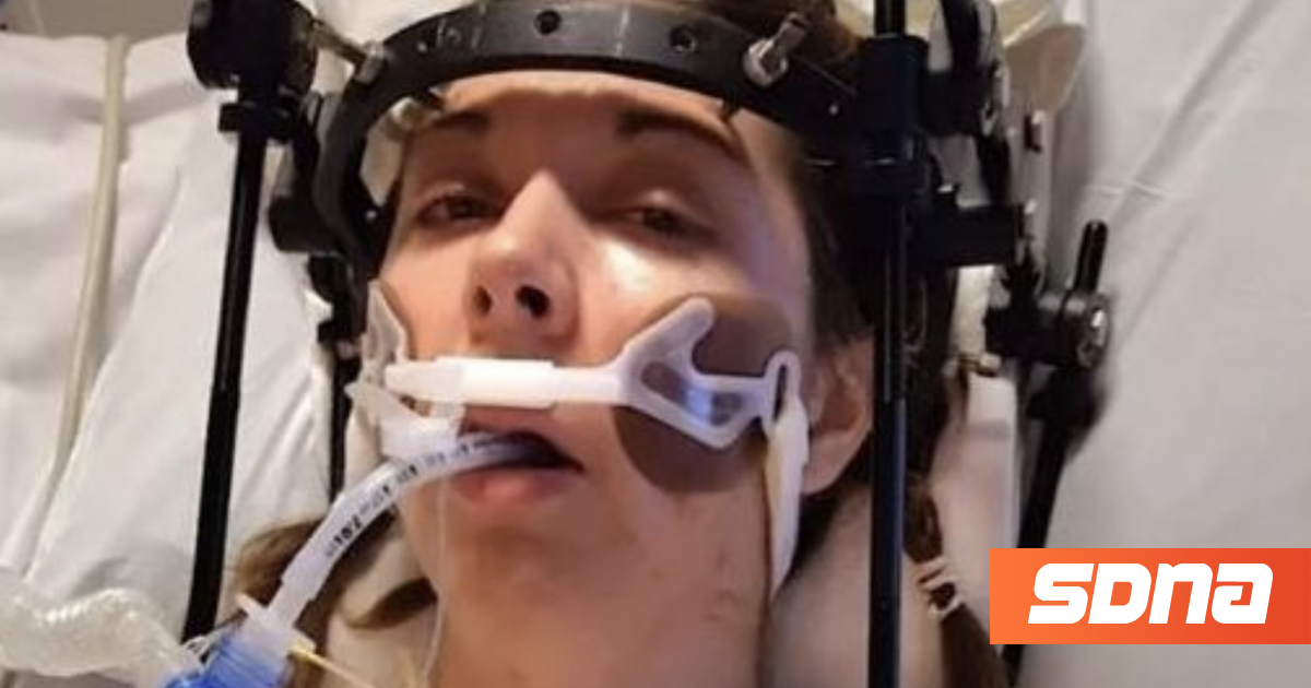 ΗΠΑ: «Αποκεφαλισμένη» γυναίκα υποβλήθηκε σε 37 επεμβάσεις για να της επανασυνδέσουν το κρανίο | SDNA